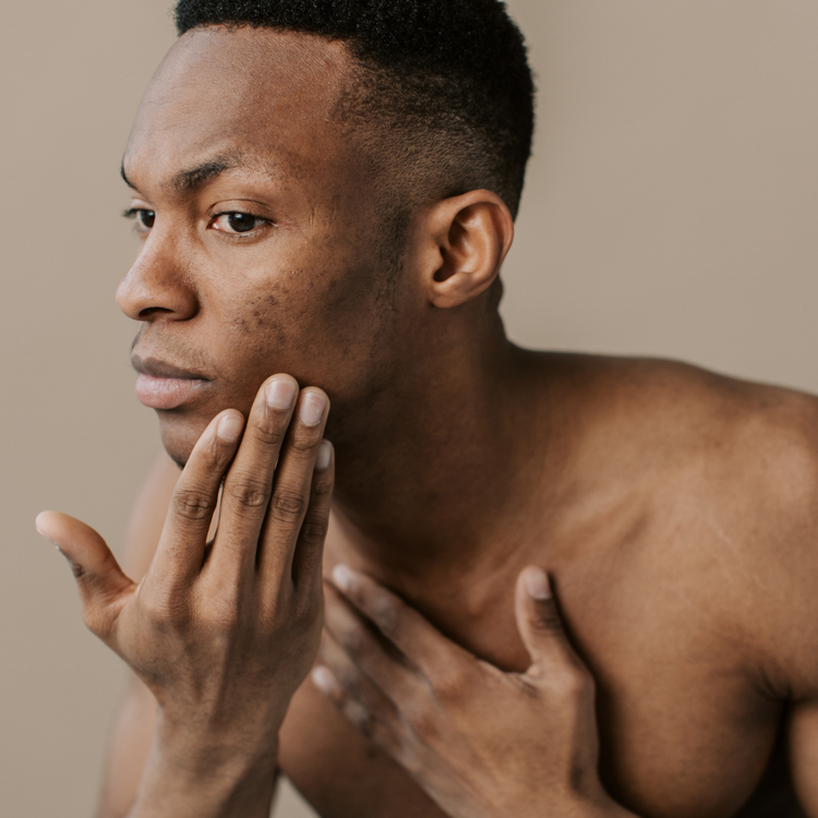 Does Creatine Cause Acne? The Science & Skin Benefits | CON-CRĒT